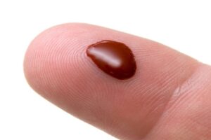 Fear Of Blood (Hematophobia): Relevant Aspects Causes, Symptoms ...